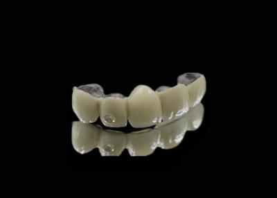 China Premium Quality Dental Product Porcelain-Fused-to-Metal (PFM) Crowns for sale