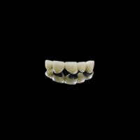 China Best Teeth Craftsman Porcelain-Fused-to-Metal (PFM) Crowns for sale