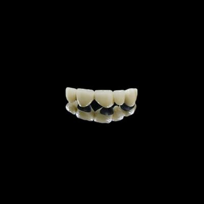 China Best Teeth Craftsman Porcelain-Fused-to-Metal (PFM) Crowns for sale