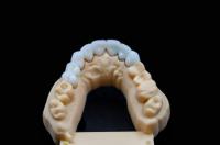 China High Purity Dental Zirconium Oxide Powder Perfect for Precision Dental Applications and Prosthetic Fabrication for sale