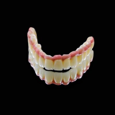 China Sterilized Dental Implant System Featuring Biocompatible Materials for Enhanced Osseointegration and Patient Comfort for sale