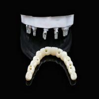 China Durable Biocompatible Artificial Tooth Root Implant Suitable for Dental Restoration Procedures and Long Term Stability for sale