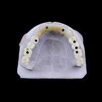 China Durable Biocompatible Artificial Tooth Root Implant Suitable for Dental Restoration Procedures and Long Term Stability for sale