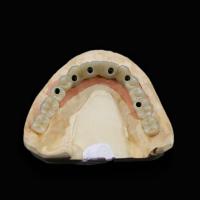 China Precision Engineered Artificial Tooth Root Offering Support and Enhanced Healing for Dental Reconstruction Applications for sale