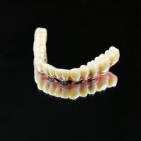 China Precision Engineered Artificial Tooth Implant Offering Optimal Fit and Functionality for Effective Dental Rehabilitation for sale