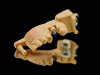 China Corrosion Resistant Artificial Tooth Root Suitable for Multiple Dental Applications Providing Secure Implant Fixation for sale