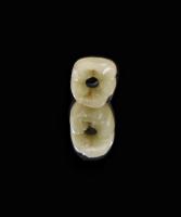 China Corrosion Resistant Artificial Tooth Root Suitable for Multiple Dental Applications Providing Secure Implant Fixation for sale