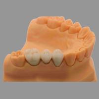 China Dental PFM Crown And Bridge Customizable With CoCr Ceramic Materials for sale