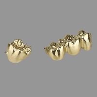 China Dental Clinics Full Gold Crown Smooth Polished Wear Resistant for sale