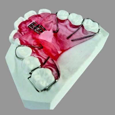 China Removable Expansion Plate Orthodontics Anterior Movement Customizable for sale