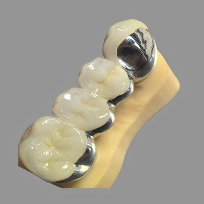 China Casting / Digital CoCr Dental PFM Bridge with Polished Surface for sale