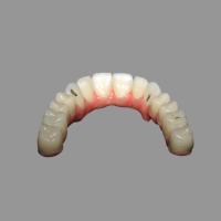 China Dental Implant Lab | Class 2 Hybrid Malong Full Arch AOX Implant Bridge Titanium Bar With Full Solid Zirconia for sale