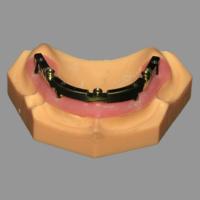 China Lmplant Dental Laboratory | Full Acrylic Denture All On X Dental Lmplants AOX Class 4 With Locator Attachment for sale