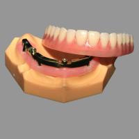 China Lmplant Dental Laboratory | Full Acrylic Denture All On X Dental Lmplants AOX Class 4 With Locator Attachment for sale