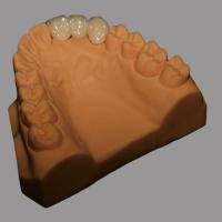 China ADL Dental Laboratories Inc | Biocompatible Full Ceramic PFZ Bridge With CAD / CAM System for sale