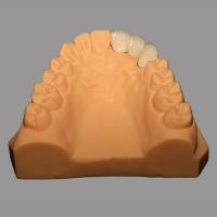 China Biocompatible Full Ceramic PFZ Bridge With CAD / CAM System for sale