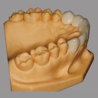 China China Outsourcing Dental Lab | Aesthetic Porcelain Fused To Zirconia Bridge Hypoallergenic for sale