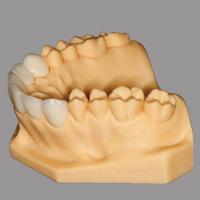 China China Outsourcing Dental Lab | Aesthetic Porcelain Fused To Zirconia Bridge Hypoallergenic for sale