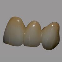 China Natural Full Contour Zirconia Bridge Single Unit / Multiunit Wear Resistant for sale