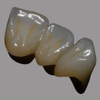 China Dental Lab Zirconia Price | Natural Full Contour Zirconia Bridge Single Unit / Multiunit Wear Resistant for sale