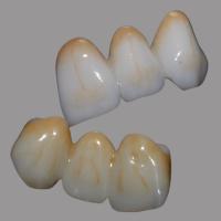 China Dental Lab Zirconia Price | Natural Full Contour Zirconia Bridge Single Unit / Multiunit Wear Resistant for sale