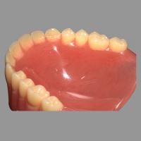China Casting Full Acrylic Denture Heat Curing Full Arch Shaped for sale