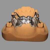 China 3D Printed CoCr Metal Framework Partial Nickel Free Lightweight for sale