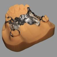 China 3D Printed CoCr Metal Framework Partial Nickel Free Lightweight for sale