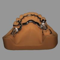 China Vitallium 2000 Cast Metal Framework Dental Bar Design Corrosion Resistant for sale