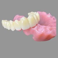 China China Dental Laboratory | CAD/CAM Digital Milled Acrylic Base Denture Removable for sale