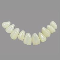 China High Translucency IPS E Max Veneers Stains Resistant Biocompatible for sale