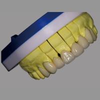 China High Translucency IPS E Max Veneers Stains Resistant Biocompatible for sale
