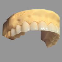 China Smooth Pressed IPS EMax Crowns Staining Resistant Customizable for sale