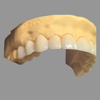China Smooth Pressed IPS EMax Crowns Staining Resistant Customizable for sale