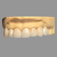 China Smooth Pressed IPS EMax Crowns Staining Resistant Customizable for sale