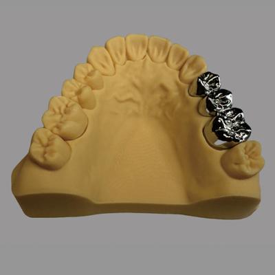 China CoCr Full Metal Crown And Bridge Smooth Polished Customizable for sale