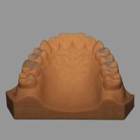 China Full Ceramic Dental Emax Inlay Onlay Crown Pressed / Milled for sale
