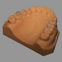 China Emax  Dental Lab | Full Ceramic Dental Emax Inlay Onlay Crown Pressed / Milled for sale