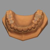 China Emax  Dental Lab | Full Ceramic Dental Emax Inlay Onlay Crown Pressed / Milled for sale