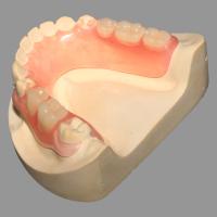 China Dental Lab Crown |  Casting Pink TCS Flexible Partials With Excellent Retention for sale