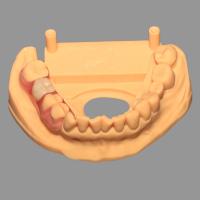 China Flexible Denture Price | ChinaCasting Valplast Dental Partials Unilateral Design Hypoallergenic for sale