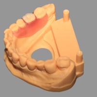 China Flexible Denture Price | ChinaCasting Valplast Dental Partials Unilateral Design Hypoallergenic for sale