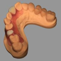 China Digital Denture Lab | Natural Looking Valplast Flexible Partial Adjustable Fracture Resistant for sale