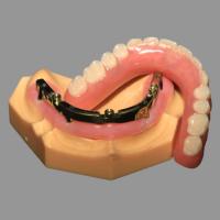 China Lmplant Dental Laboratory | Full Acrylic Denture All On X Dental Lmplants AOX Class 4 With Locator Attachment for sale