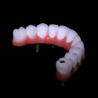 China China Outsourcing Dental Lab | Dental PFM Crown And Bridge Customizable With CoCr Ceramic Materials for sale