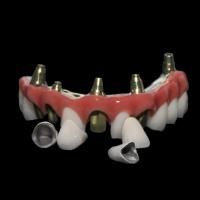 China China Outsourcing Dental Lab | Dental PFM Crown And Bridge Customizable With CoCr Ceramic Materials for sale