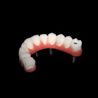 China AOX Class I All On 4 Dental Implants Hybrid Titanium Screw Retained PFM for sale