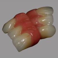 China Digital Design Dental Lab | CAD / CAM Dental Layered Zirconia Bridge With Pink Porcelain for sale