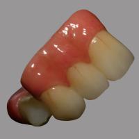China Digital Design Dental Lab | CAD / CAM Dental Layered Zirconia Bridge With Pink Porcelain for sale