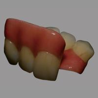 China Digital Design Dental Lab | CAD / CAM Dental Layered Zirconia Bridge With Pink Porcelain for sale